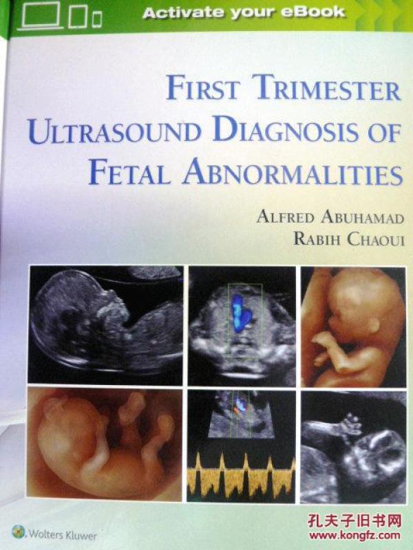 英文原版 First Trimester Ultrasound Diagnosis of Fetal Abnormalities 胎儿 超声诊断_Alfred Z. MD , Rabih ...